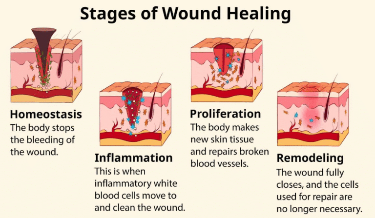 Chronic Wound Healing Guide | TenMed